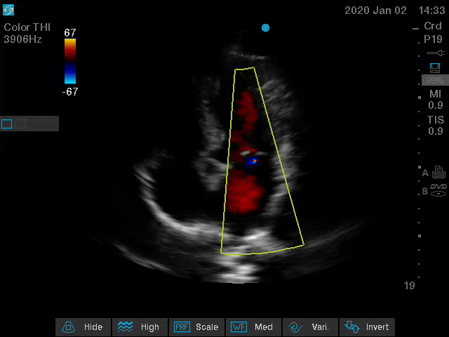8 Best Portable Echo Ultrasound Machines for Cardiac Care