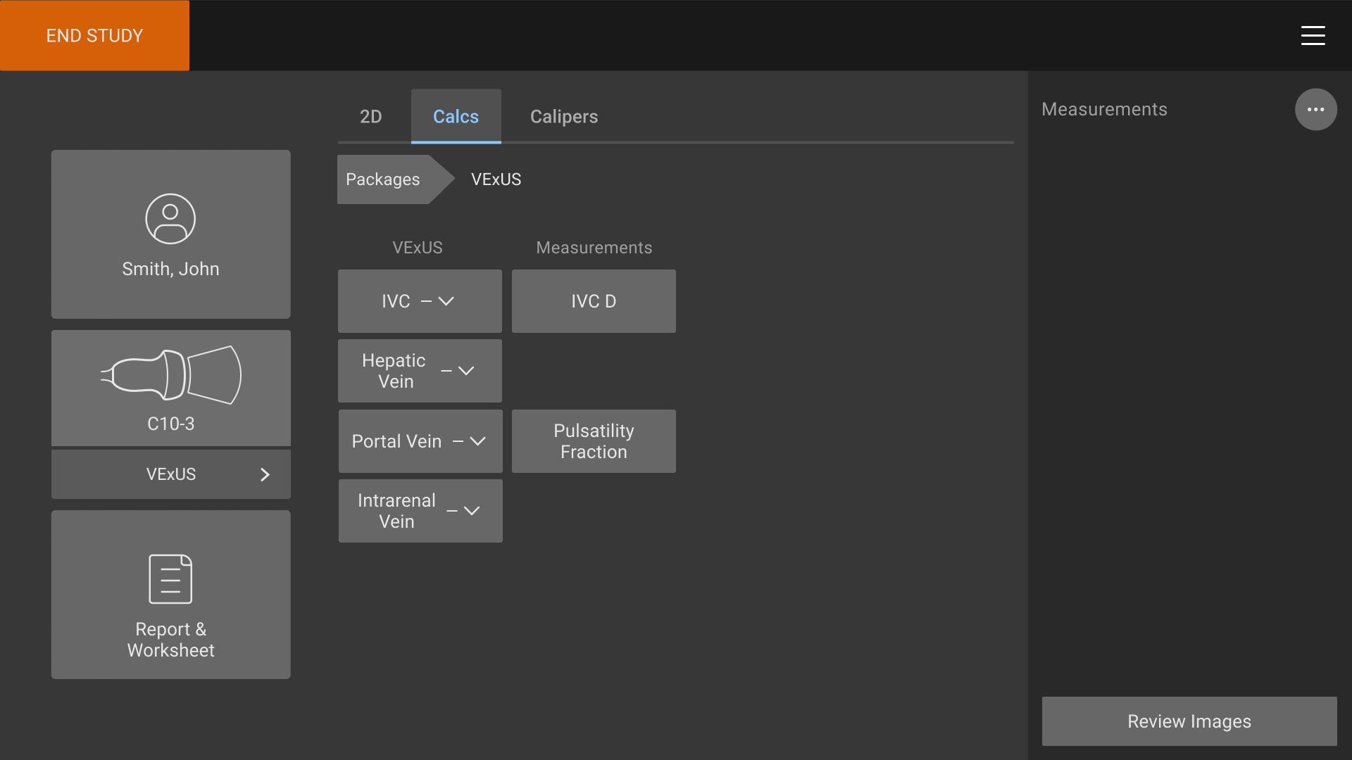 VExUS Ultrasound Exam Introduction | FUJIFILM Sonosite