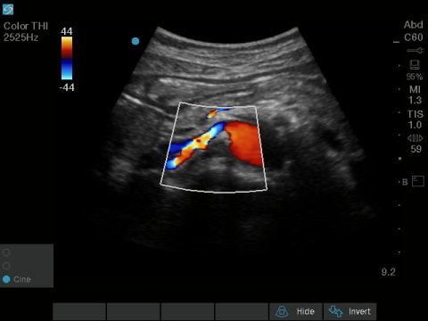 Sonosite Edge II | FUJIFILM Sonosite